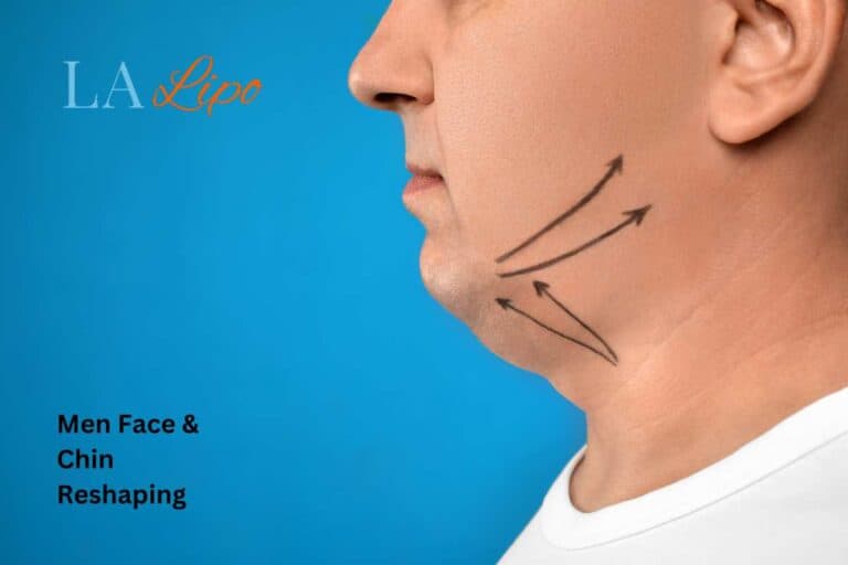 Mens Chin Fat Reduction Treatments